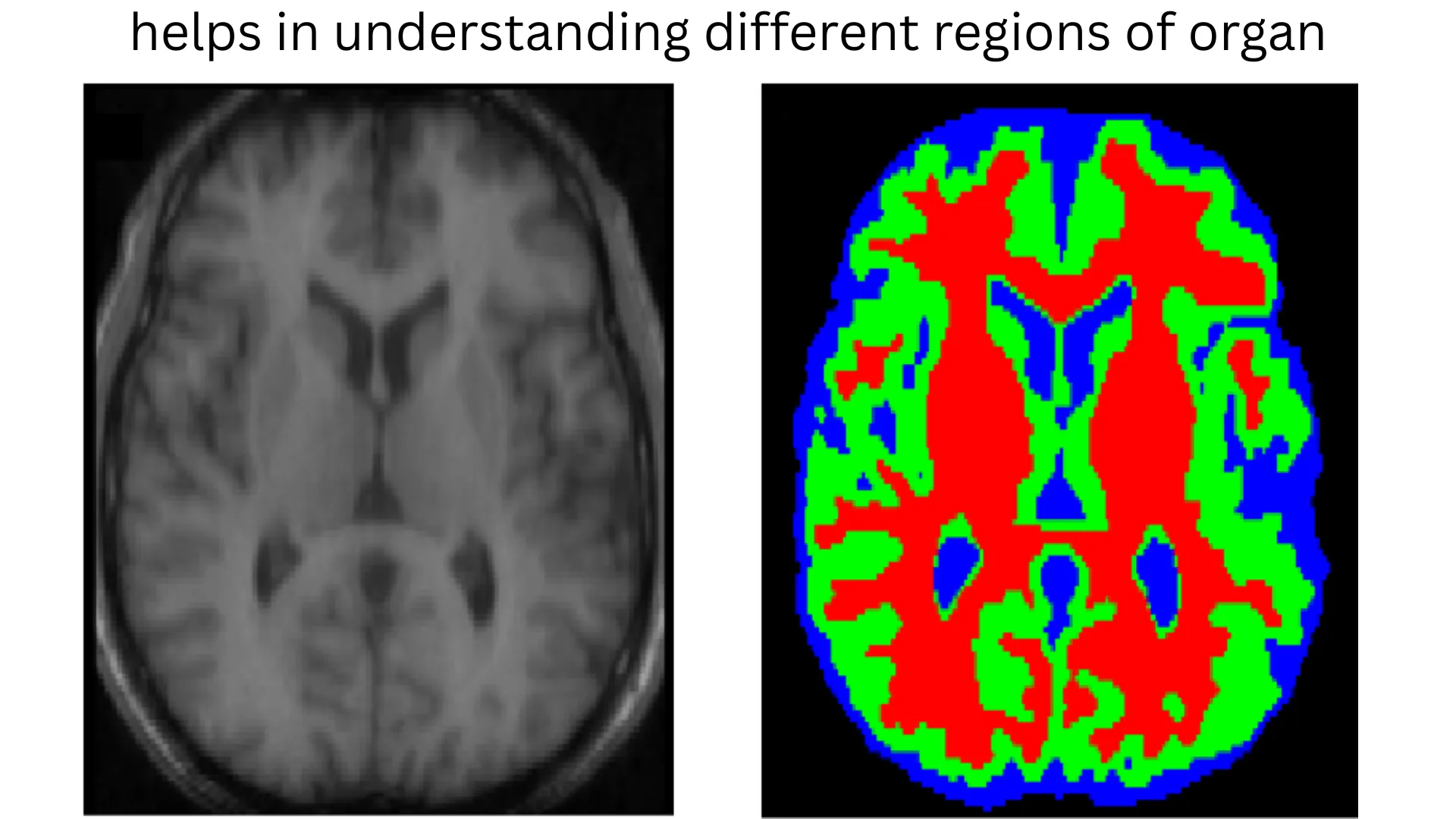 SegFormer Tutorial: Master Semantic Segmentation Fast